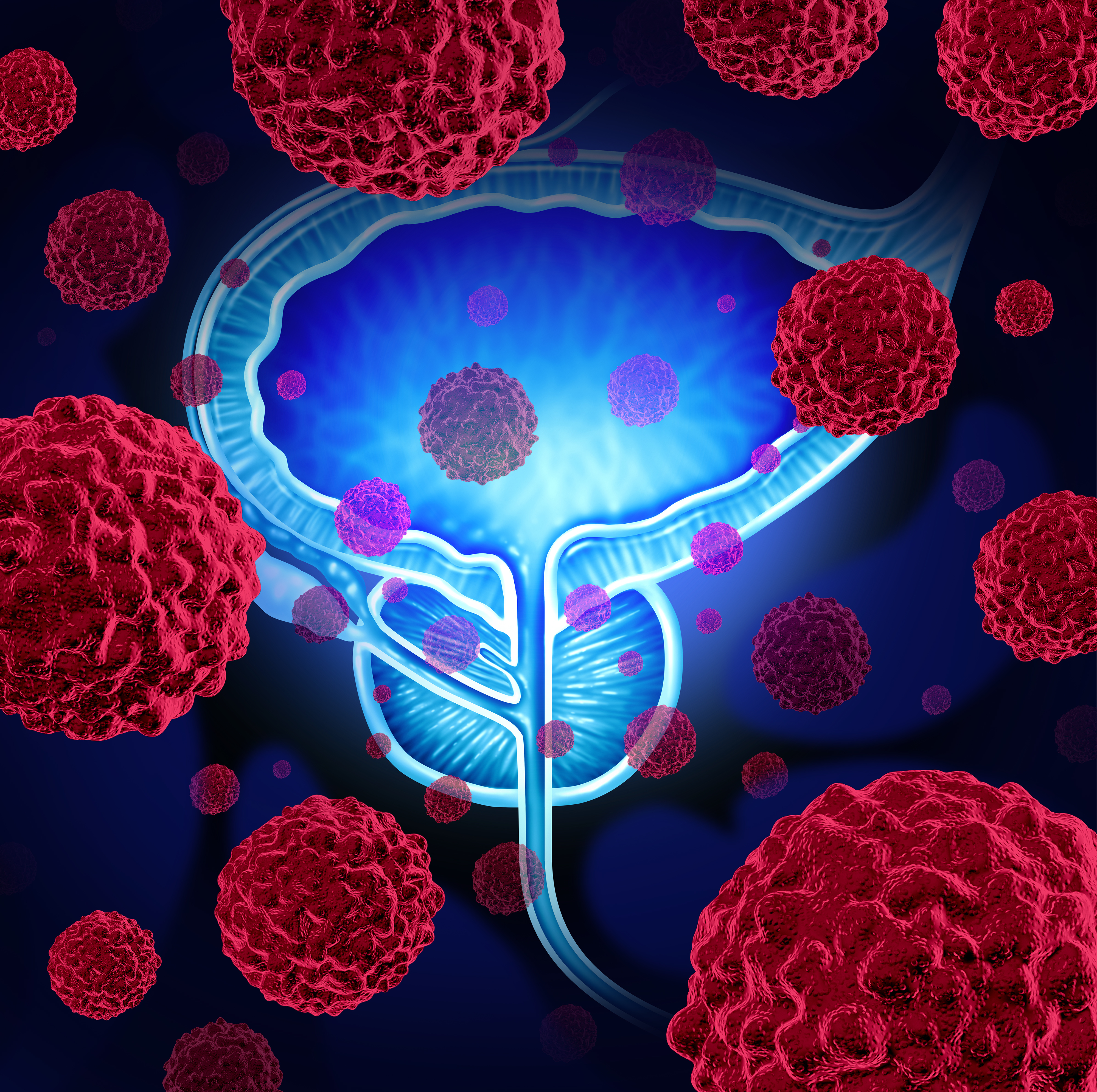 On-Demand Webinar: Modeling Prostate Cancer Therapies with Humanized Mice